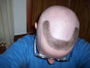 The Biggest Contribution Of Horseshoe Haircut To Humanity | horseshoe ...